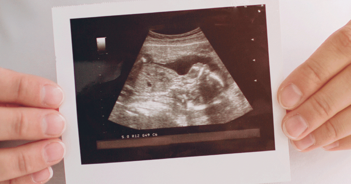 Det skal du huske, når du skal på barsel